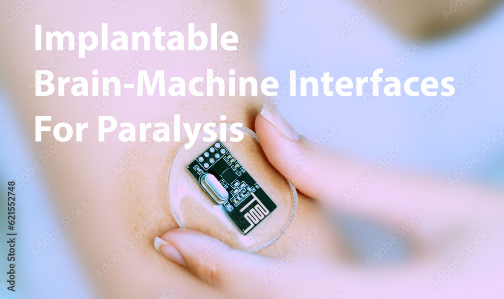 Implantable Brain-Machine Interfaces For Paralysis Implantable ...