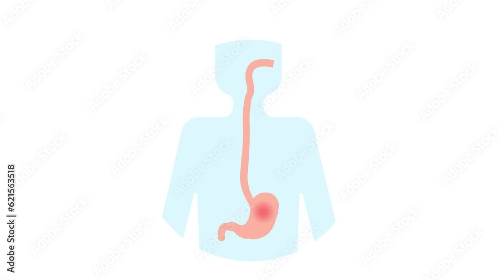 stomach pain from gastric ulcer or gastrointestinal system disease ...