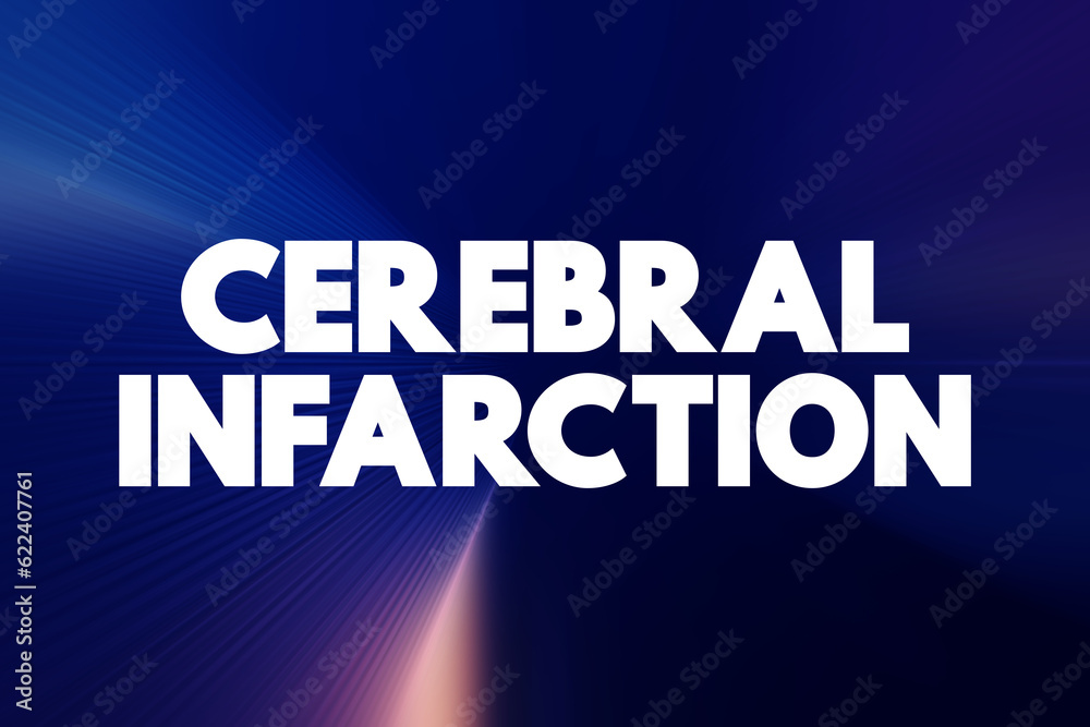 Cerebral Infarction - pathologic process that results in an area of ...