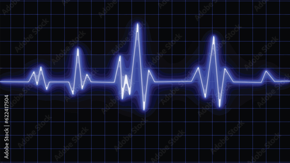 Heartbeat pulse rate line. Heart rate graphics. Electrocardiogram ...