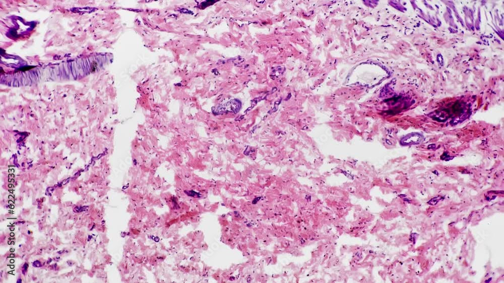 Smooth muscle of human being in longitudinal section filmed under ...