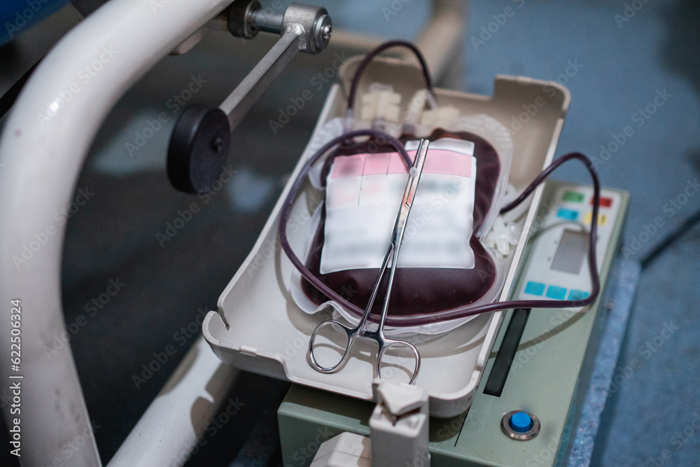 Foto de blood bag after blood transfusion with scissor clamps to ...