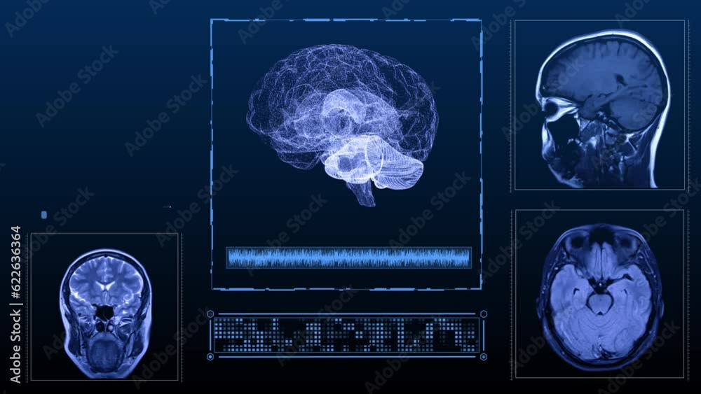 MRI of the brain in different projections on the screen on a dark ...