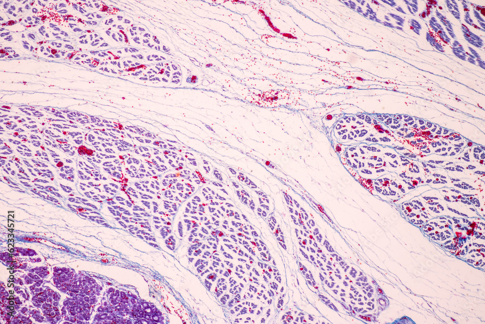 Showing Light micrograph of the Trachea, Thymus, Parathyroid gland and ...