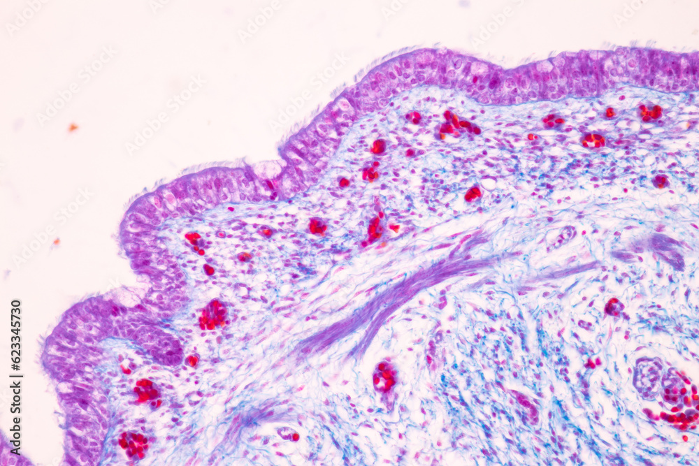 Showing Light micrograph of the Trachea, Thymus, Parathyroid gland and ...