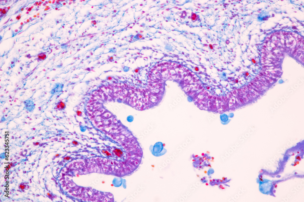 Showing Light micrograph of the Trachea, Thymus, Parathyroid gland and ...