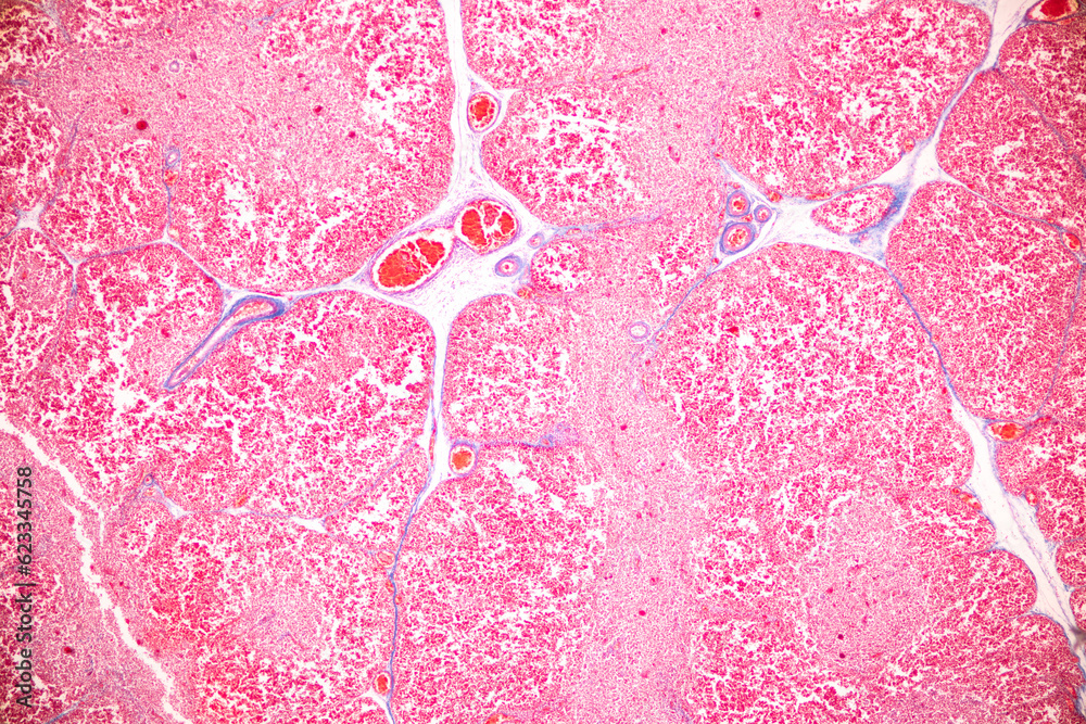 Showing Light micrograph of the Trachea, Thymus, Parathyroid gland and ...