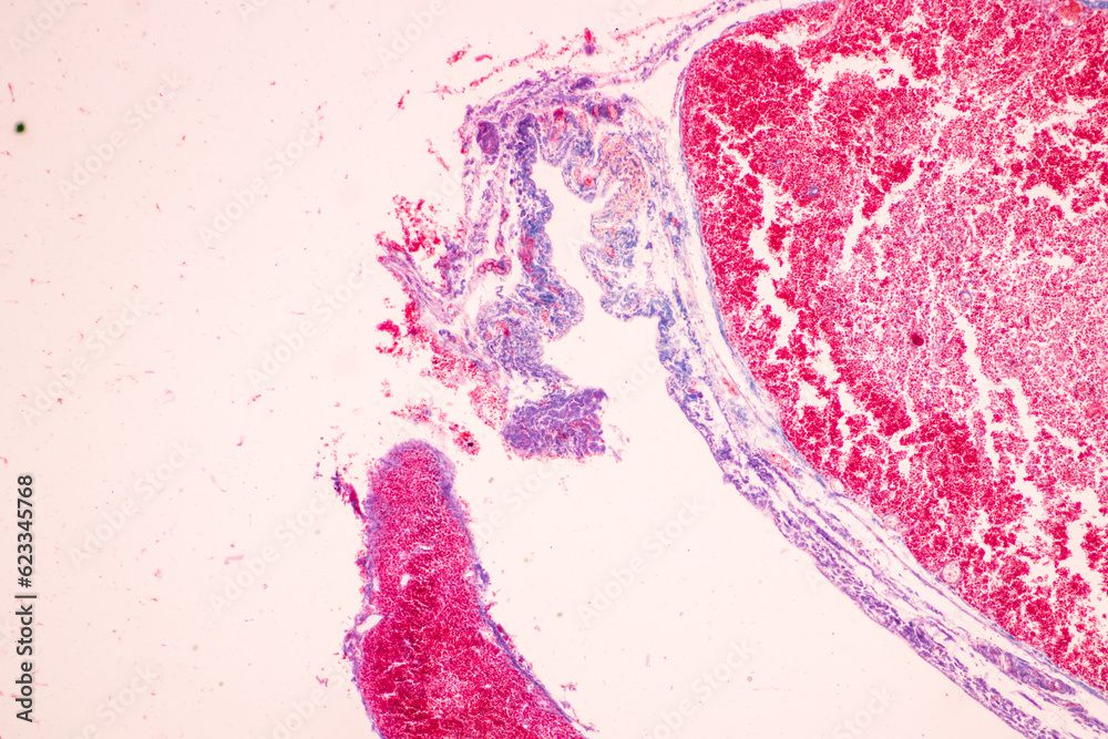 Showing Light micrograph of the Trachea, Thymus, Parathyroid gland and ...