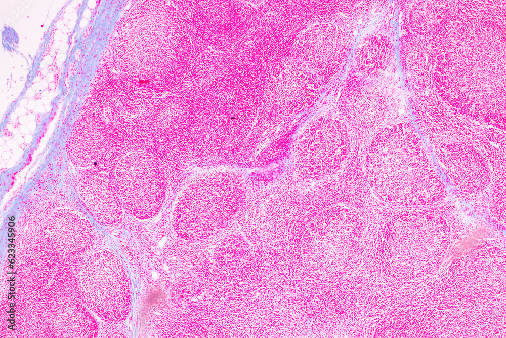 Showing Light micrograph of the Trachea, Thymus, Parathyroid gland and ...