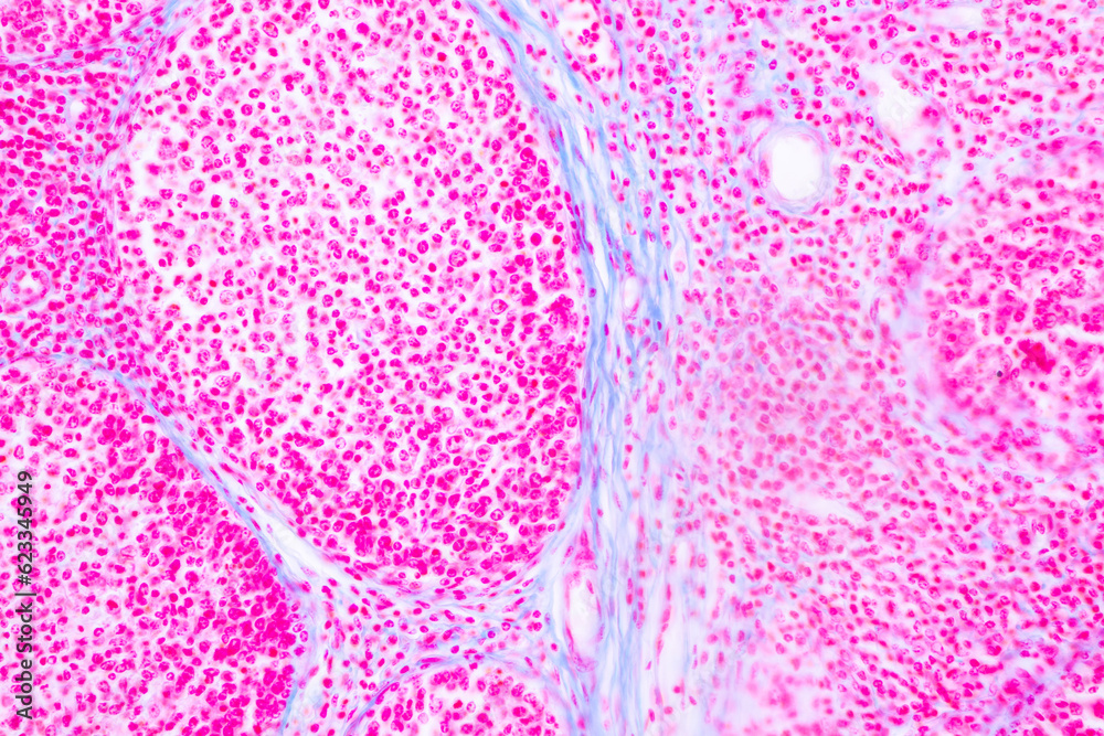 Fotografia do Stock: Showing Light micrograph of the Trachea, Thymus ...