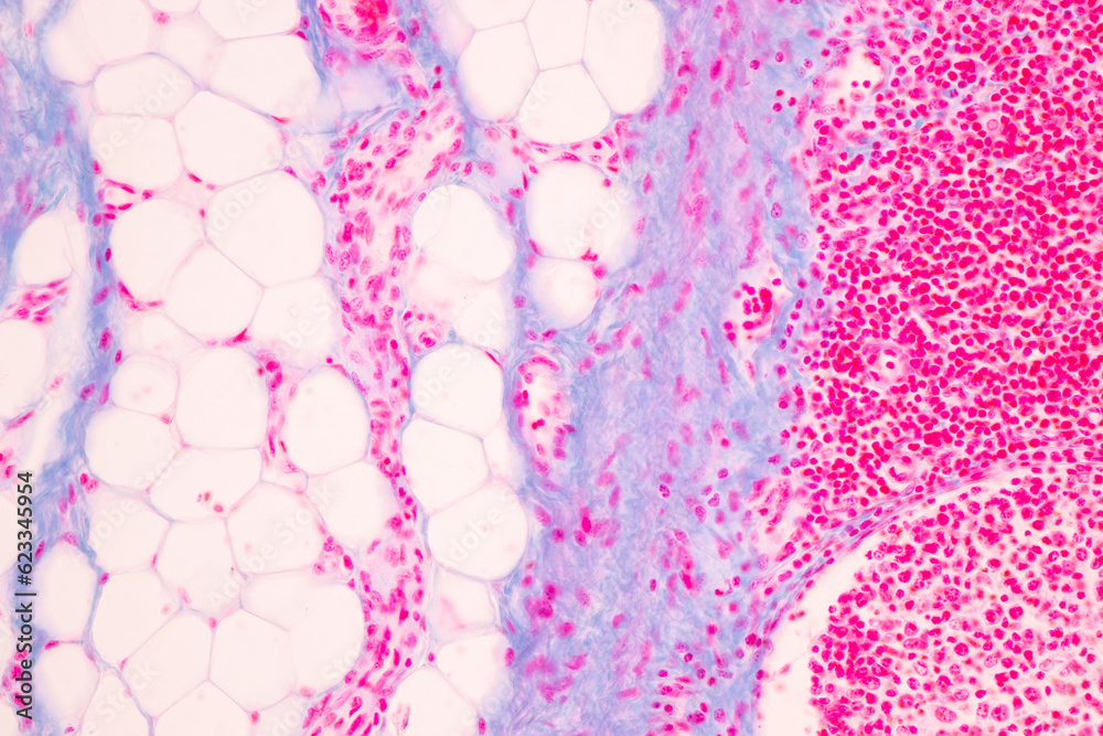 Showing Light micrograph of the Trachea, Thymus, Parathyroid gland and ...
