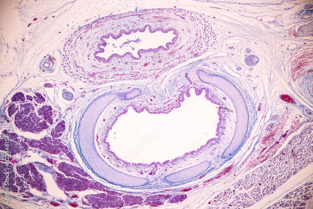 Showing Light micrograph of the Trachea, Thymus, Parathyroid gland and ...
