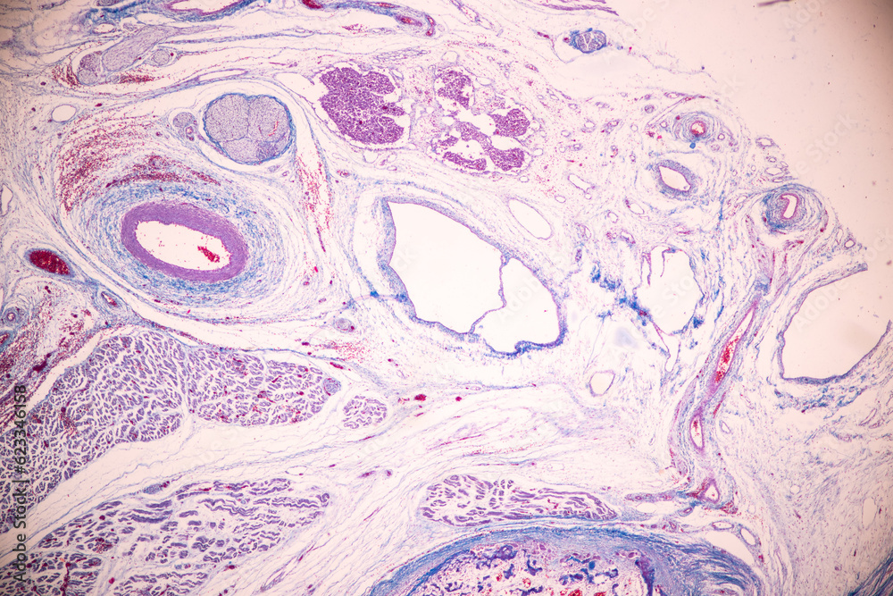 Showing Light micrograph of the Trachea, Thymus, Parathyroid gland and ...