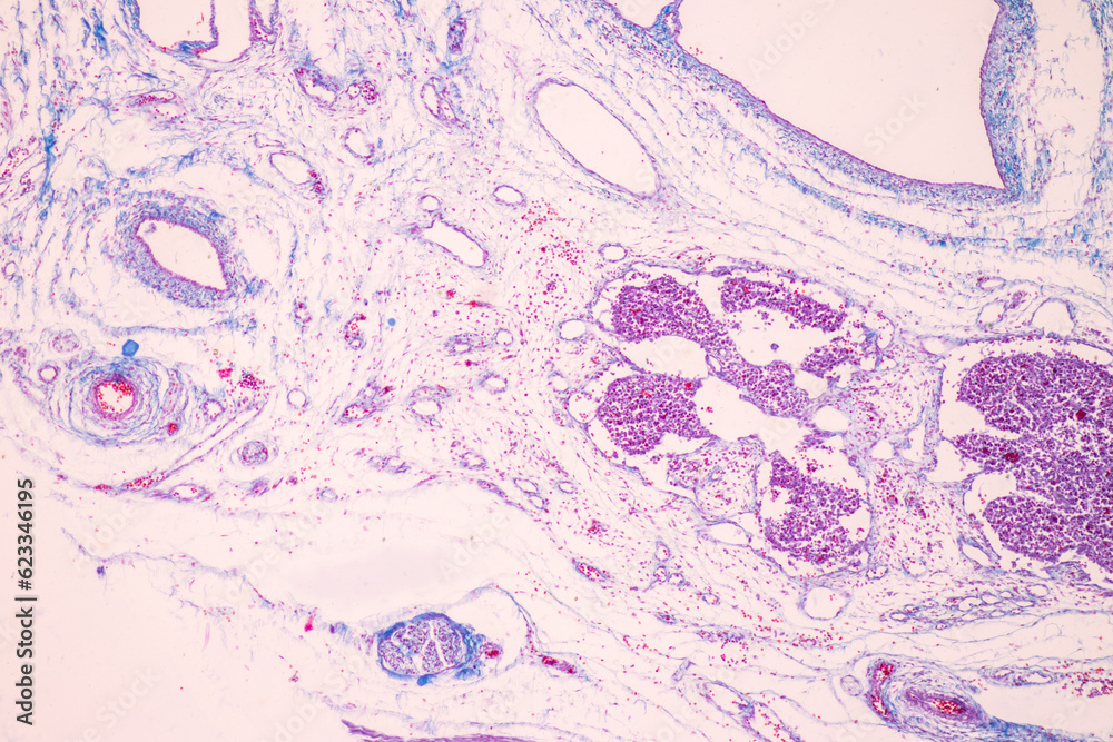 Showing Light micrograph of the Trachea, Thymus, Parathyroid gland and ...