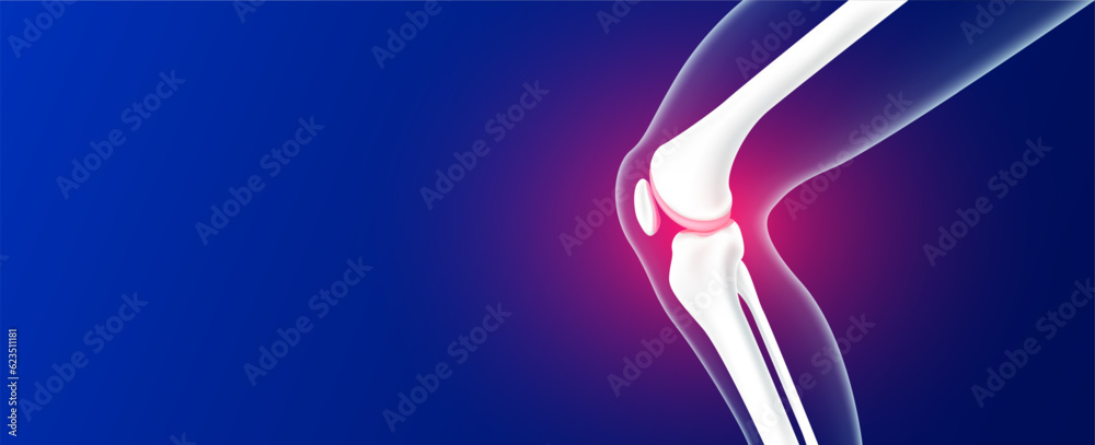 Leg bones and knee joint cartilage inflammation on blue background with ...