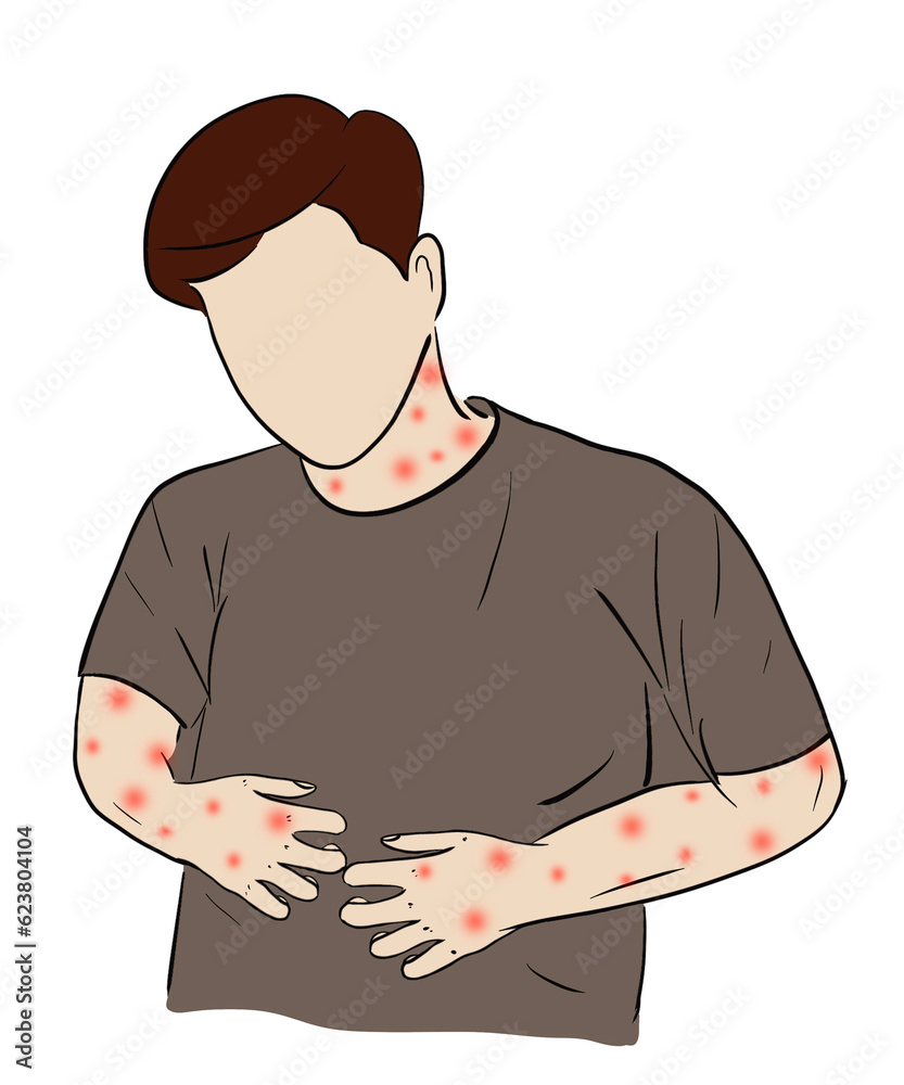 hand drawn cartoon illustration of a man with allergies red rash ...