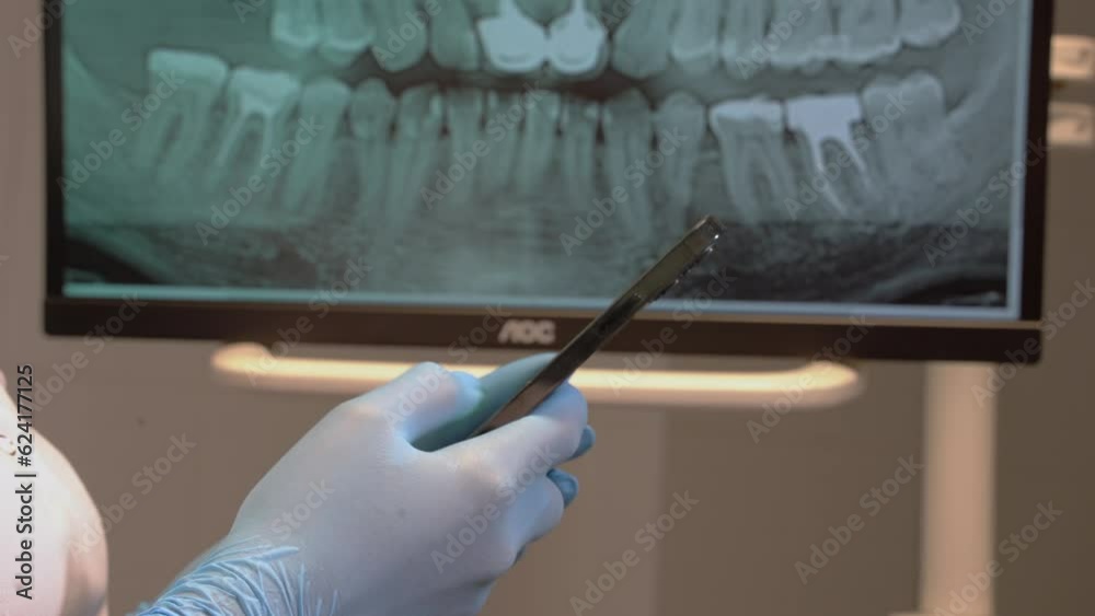 Closeup dentist hands sterile glove hold green screen cellphone at ...