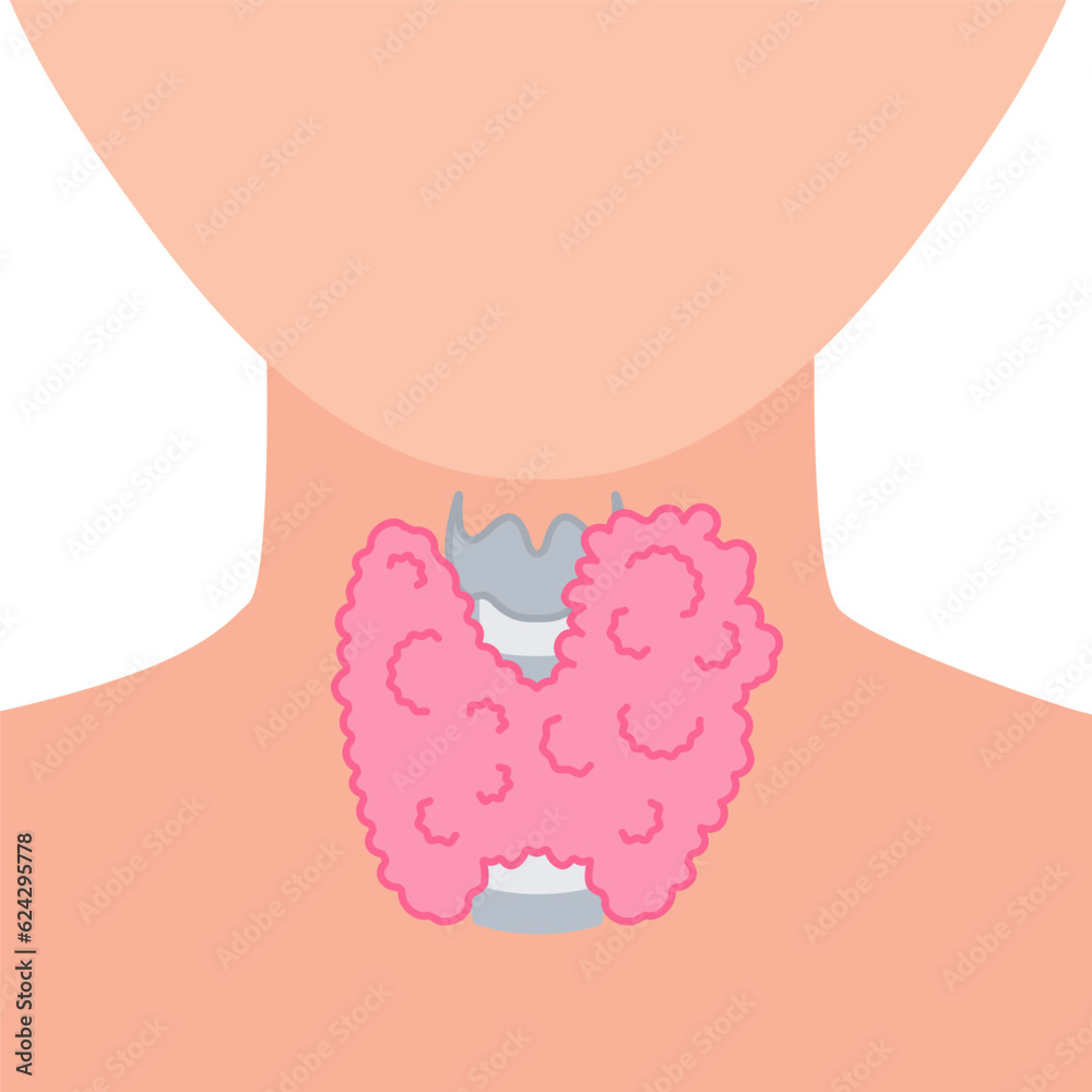 Enlarged thyroid gland lobe icon. Faceless body silhouette. Thyroid ...