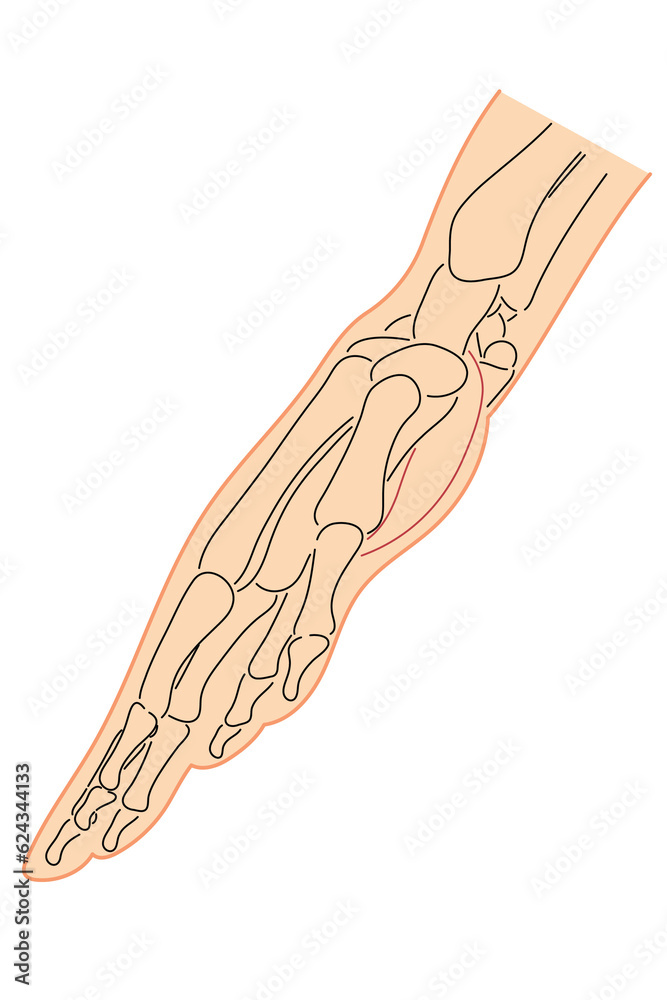 Medical illustration of Abductor pollicis brevis hands muscle. Line ...