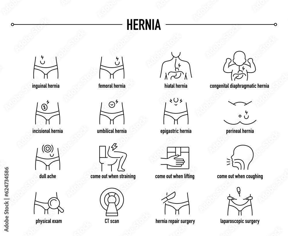 Hernia symptoms, diagnostic and treatment vector icon set. Line ...