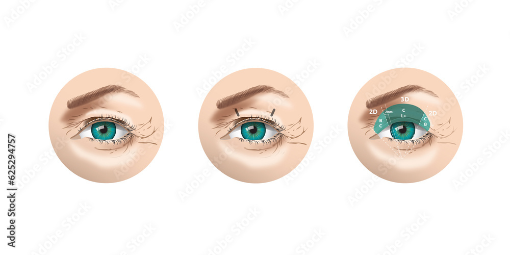 Volume lash extensions for hooded or mature eyelid type. Eyelash ...