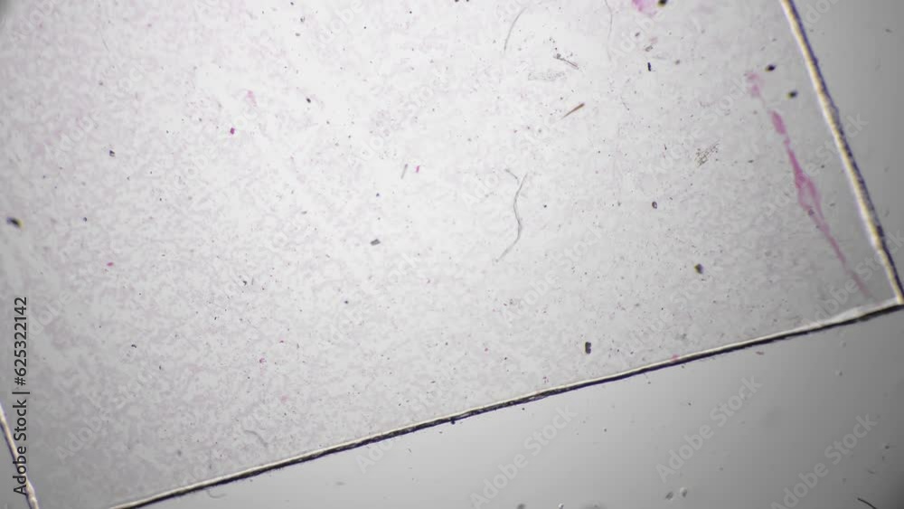 Blood smear magnified under microscope in 40 times against white ...