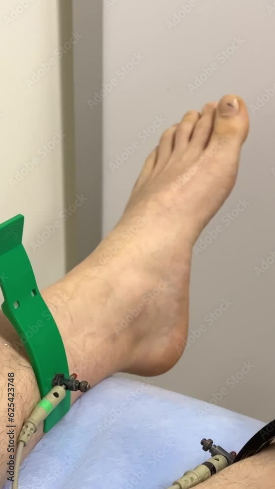 Electrode of ECG tracing of ill patient in the intensive care unit ECG ...