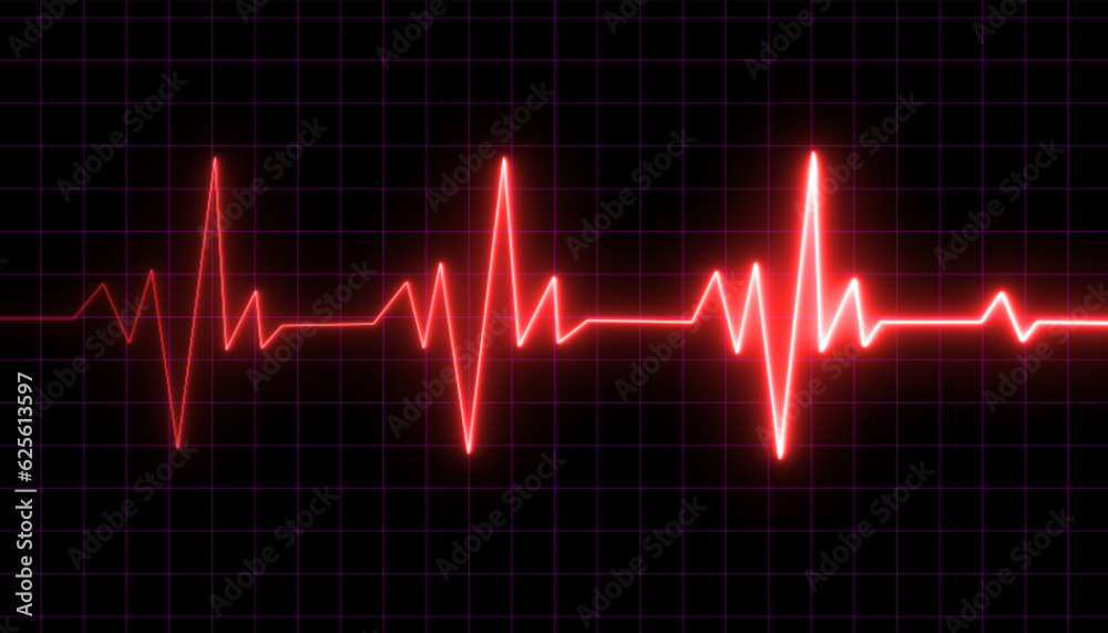 The heartbeat. EKG monitoring in an emergency. Electrocardiogram, or ...