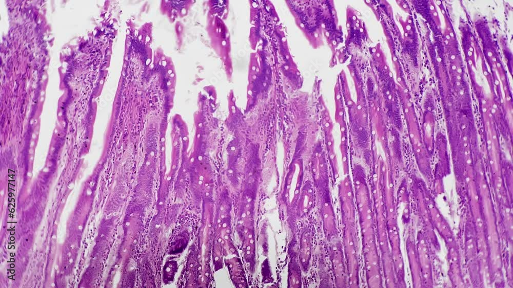 Section of human jejunum filmed under scientific microscope 100x on ...