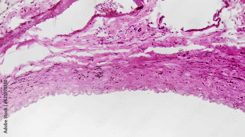 Isolated macro footage of human vein in section magnified under ...