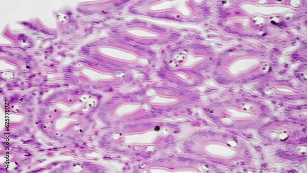 Large intestine of human being in section magnified under microscope in ...