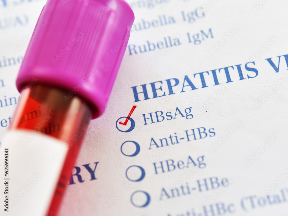 Poster Blood sample tube with laboratory requisition form for hepatitis ...