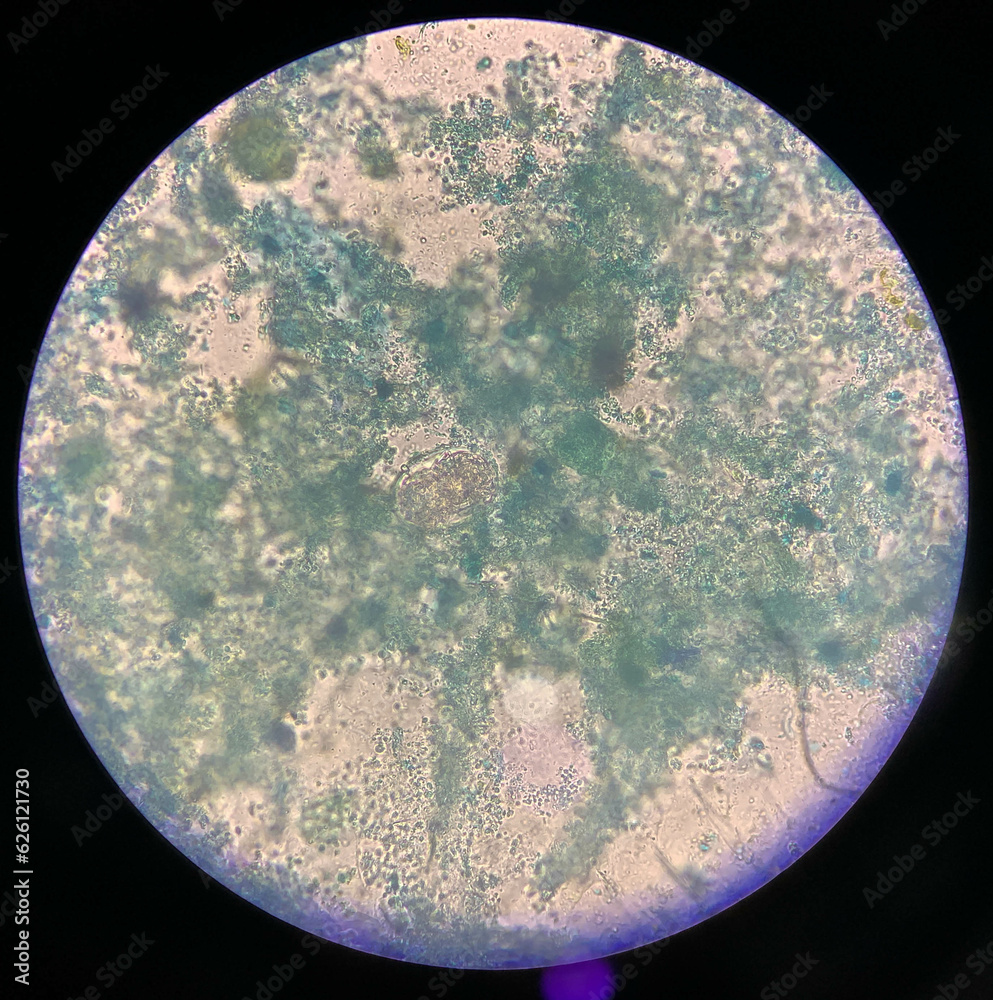 Ascaris lumbricoides eggs of the parasite in humans in stool ...