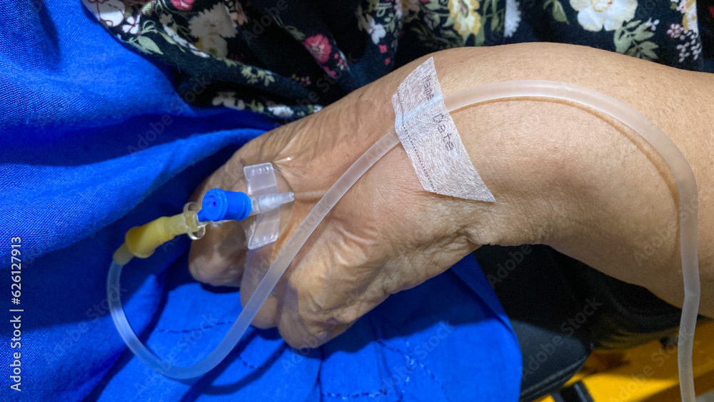 Close up hand of senior patient with intravenous catheter for injection ...