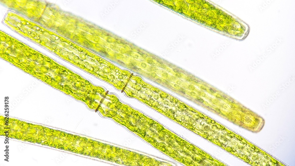 Freshwater microalgae (Pleurotaenium sp.) blooming under microscope ...