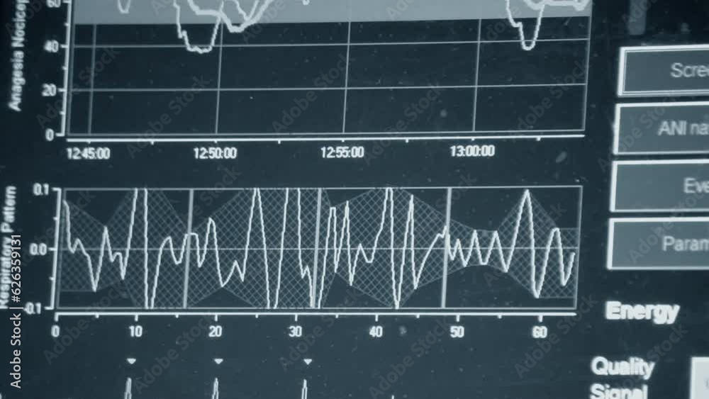 Modern patient monitor. Electronic Health Monitor displaying medical ...