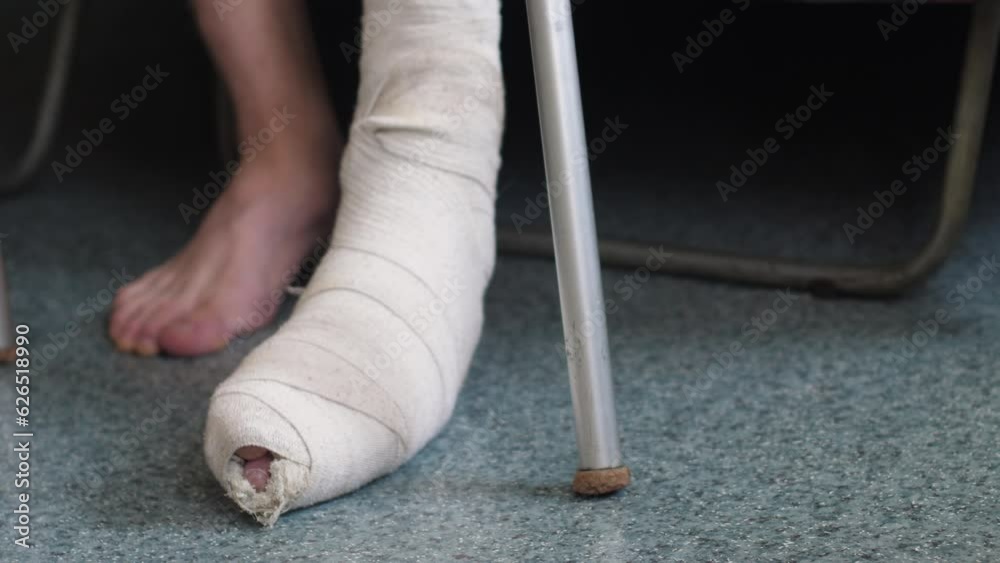 a man with a cast bandaged with a broken leg gets up from the sofa and ...