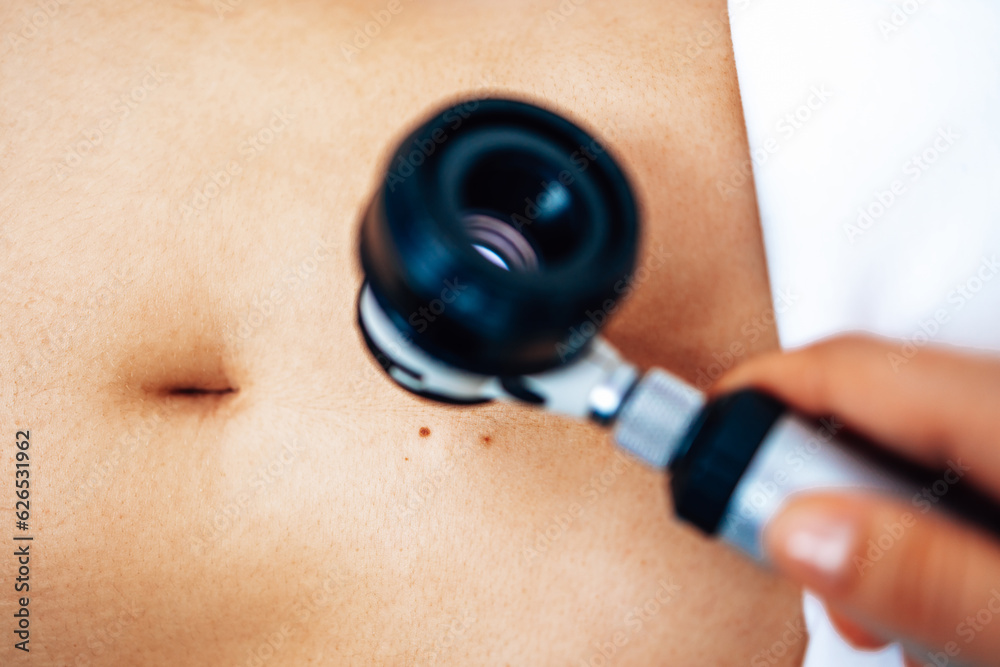 Close up shot of modern dermatology skin check up with digital ...