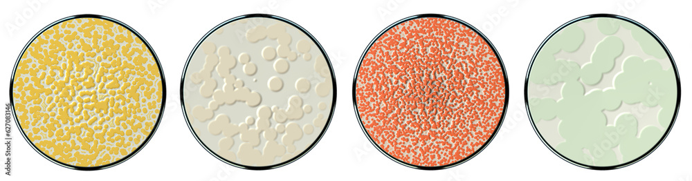 bacterial cultures in Petri dishes set - types of cell cultures in ...