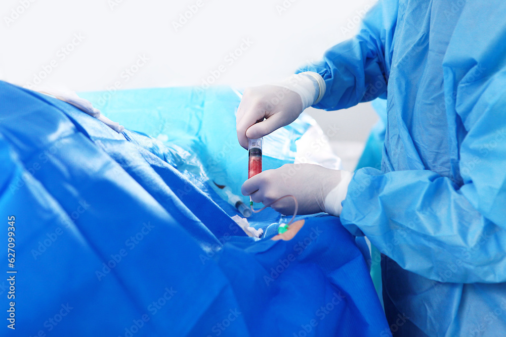 Endovascular surgery. Surgery on blood vessels. Surgical interventions ...