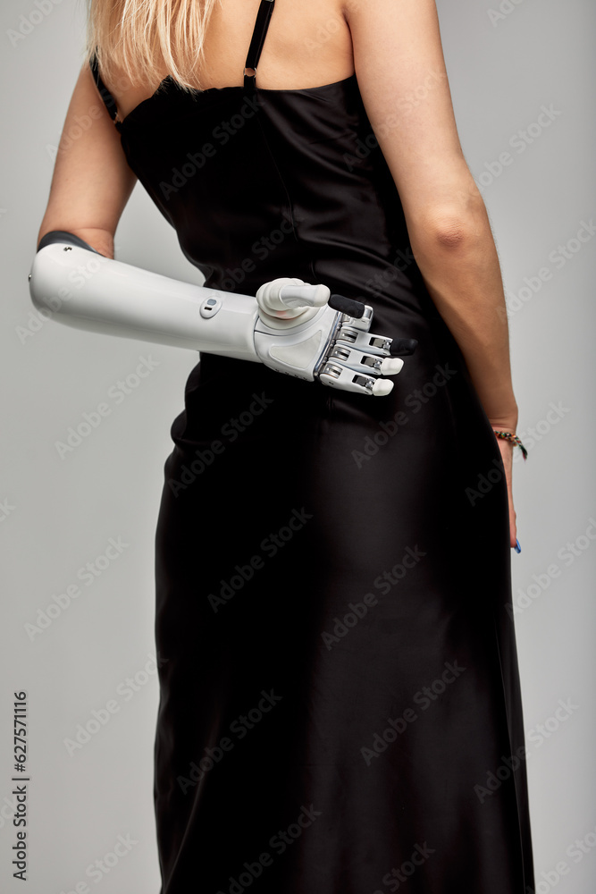 Cropped studio portrait of charming girl with disability wearing ...