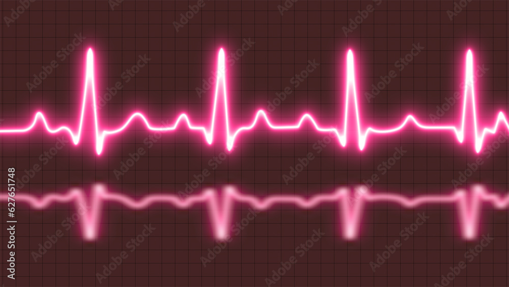 ECG or EKG graph, Cardiogram heartbeat heat pulse glowing red neon ...