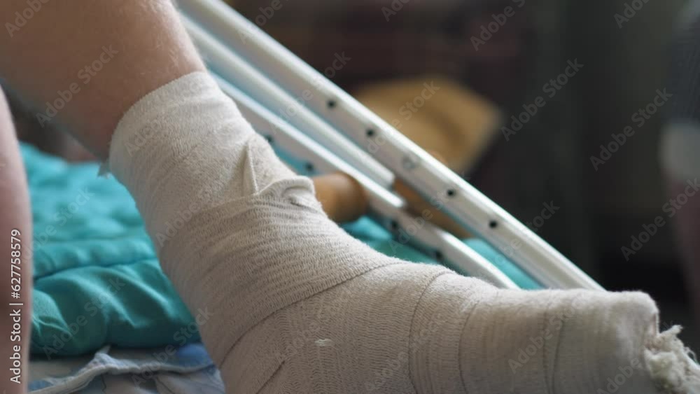 close-up of a man rewinding his plastered leg after a fracture with an ...