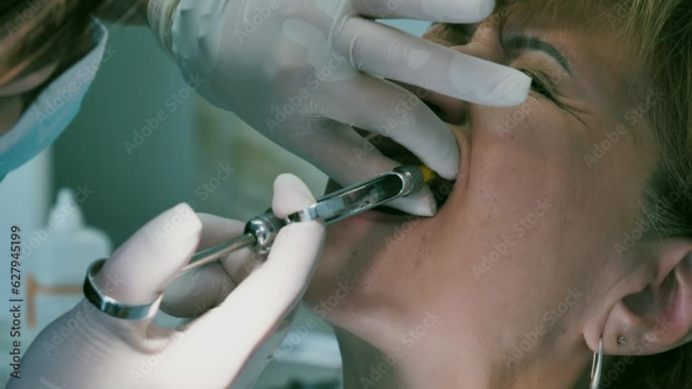 Video „anesthesia in dentistry. anesthesia. the dentist injects an ...