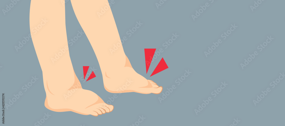 Vector illustration of swelling feet. Healthcare kidney problems ...