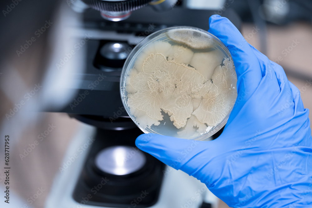 Scientist holding agar plate for diagnosis bacterial or microorganism ...