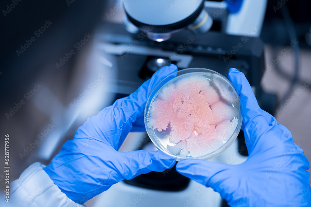 Scientist holding agar plate for diagnosis bacterial or microorganism ...