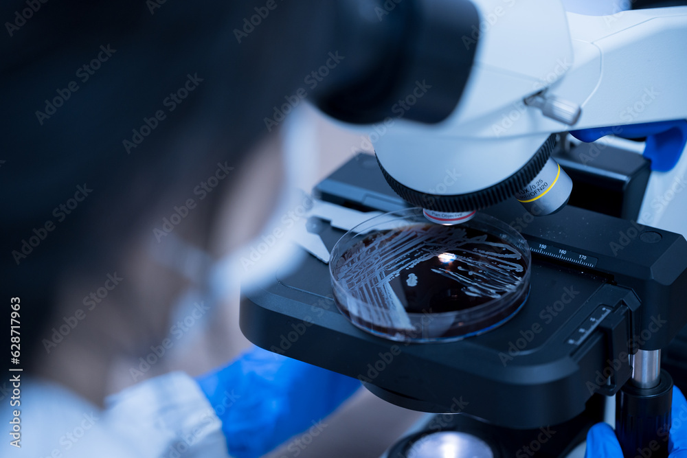 Scientist holding agar plate for diagnosis bacterial or microorganism ...