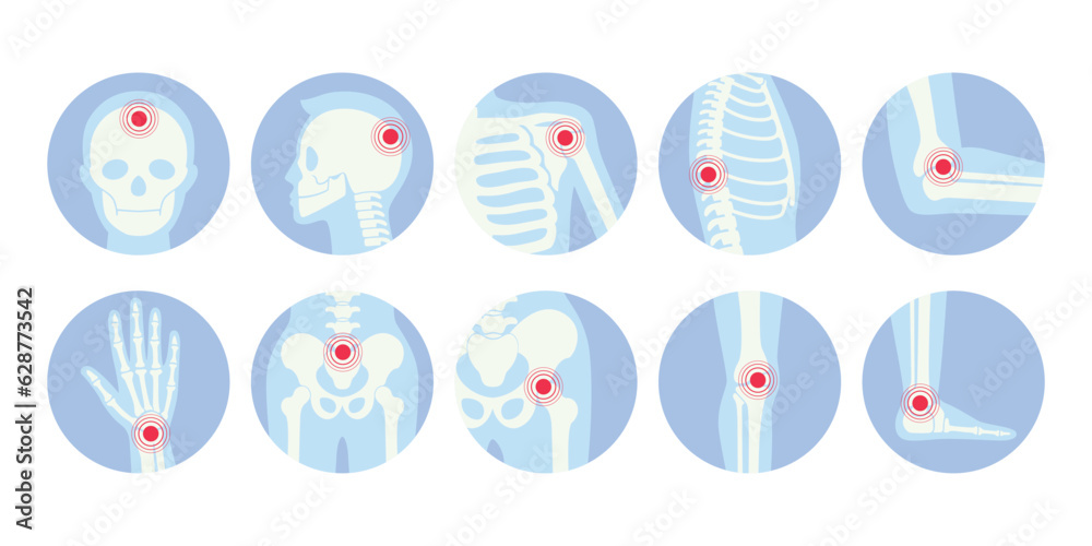 Human skeleton pain points icon set vector flat illustration Stock ...
