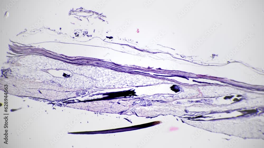 Skin section through hair follicle filmed under microscope 40x on ...